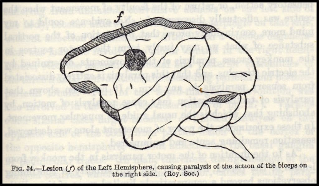 Sir David Ferrier | The Brain | July 2018 Notes from the John Martin ...