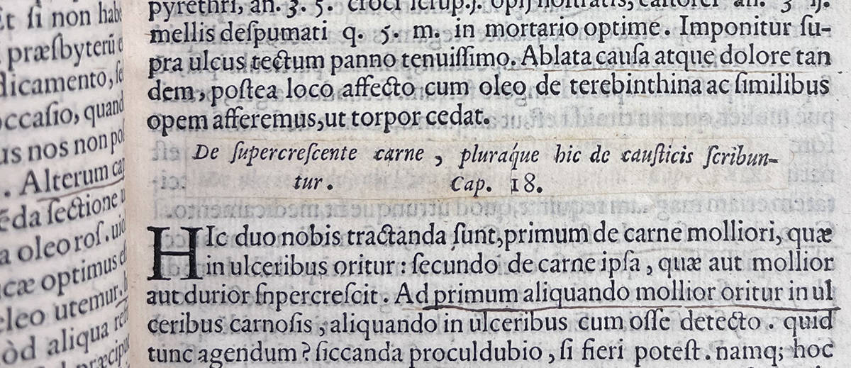 Anatomist Gabriel Fallopius | John Martin Rare Book Room @Hardin ...