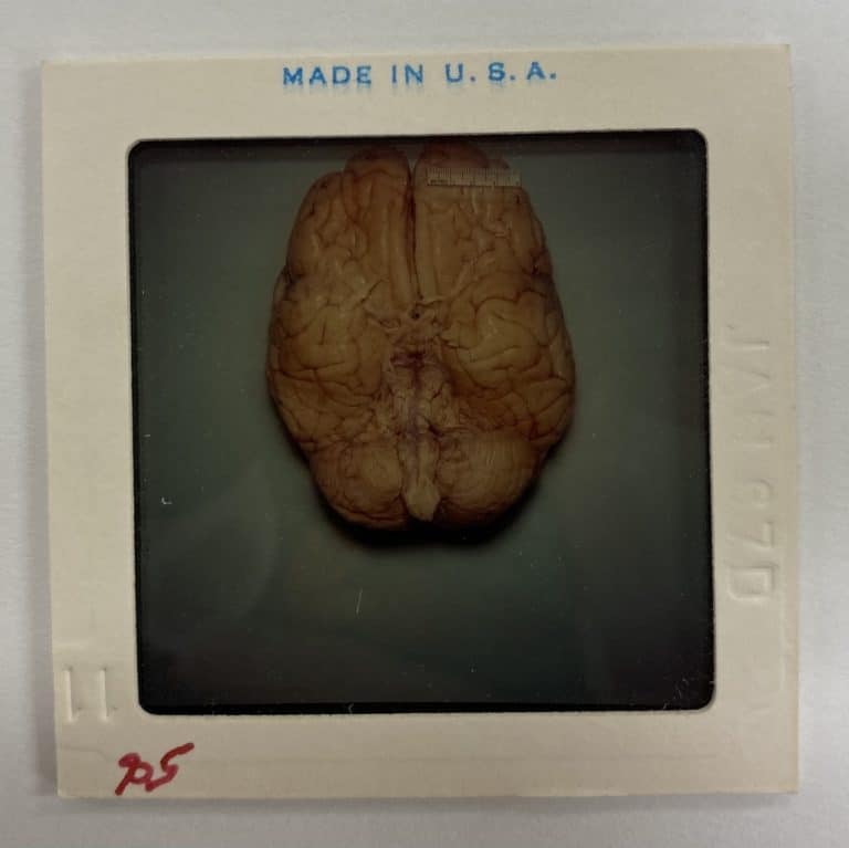 A Unique Perspective: The JFK Assassination Through the Lens of the ...